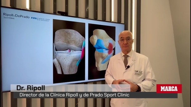 El análisis del doctor Ripoll de la lesión de Camavinga - MARCA MEXICO