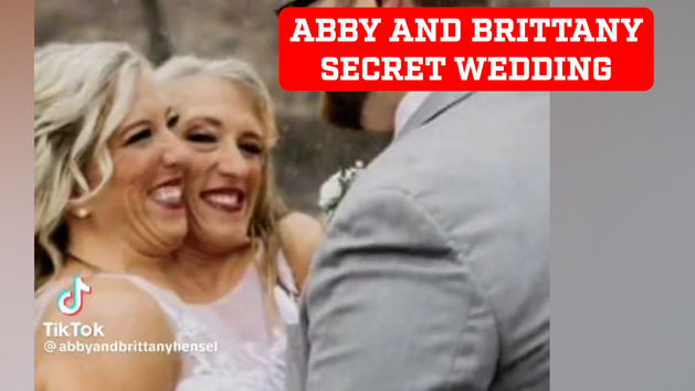 Abby Hensel from 'Abby & Brittany' Secretly Ties the Knot and is now ...