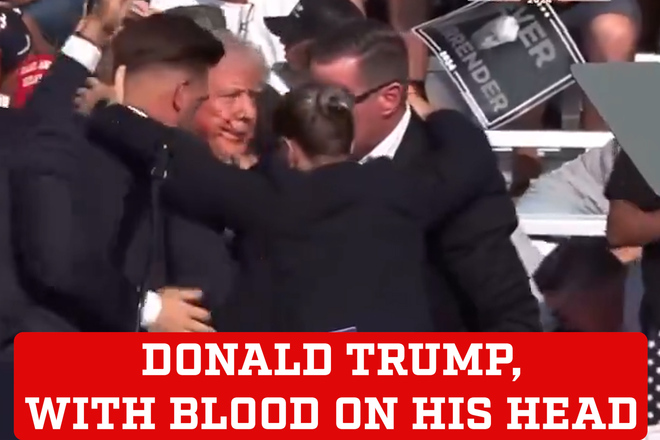 Donald Trump's personal doctor reveals a full chunk of his ear was ...