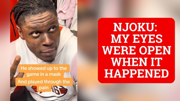 David Njoku opens up on facial burn accident: my eyes were open - MARCA ...