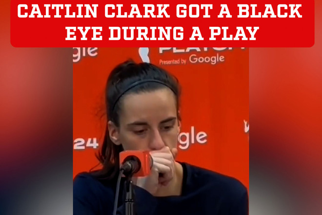 Caitlin Clark suffers black eye by slap in WNBA playoff debut | Marca