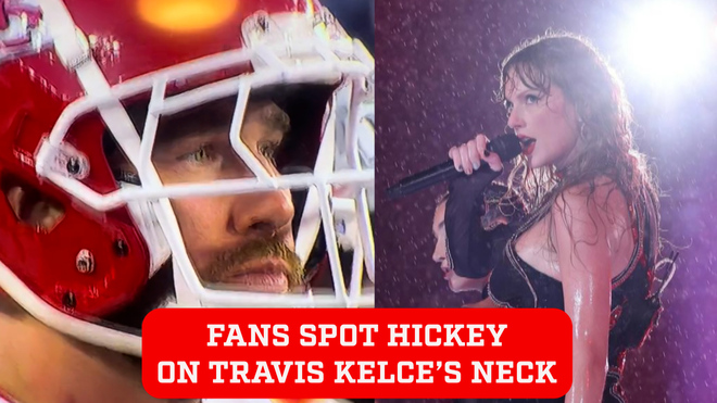 Travis Kelce spotted with huge 'hickey' on neck... Was Taylor Swift ...
